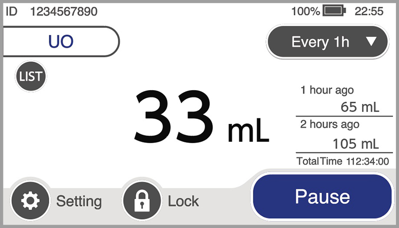 URINE MEASUREMENT AND RECORDING SYSTEM｜ISHIDA MEDICAL